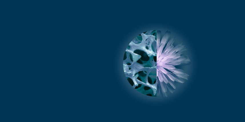 Bracken | Musculoskeletal Services